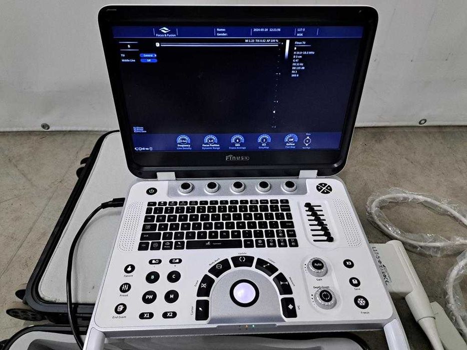 Aparat USG Focus&Fusion Healthcare Finus 70 - sprzęt powindykacyjny ...