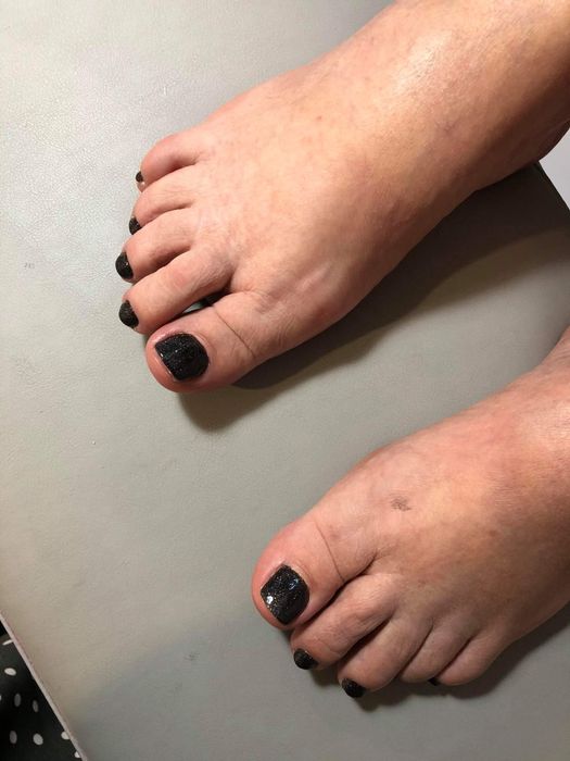 Hybryda stopy paznokcie Bytom • OLX.pl