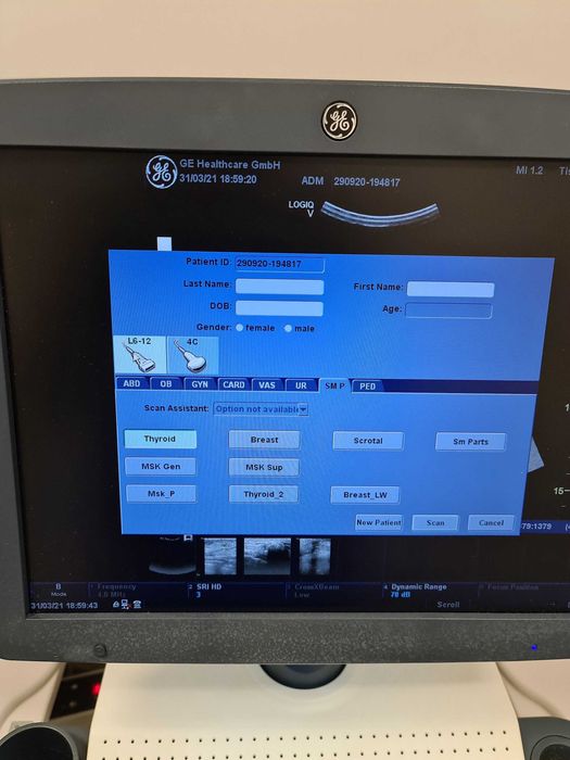 USG GE LOGIC V5 + 2 głowice KRAKÓW Kraków Bieżanów-Prokocim • OLX.pl